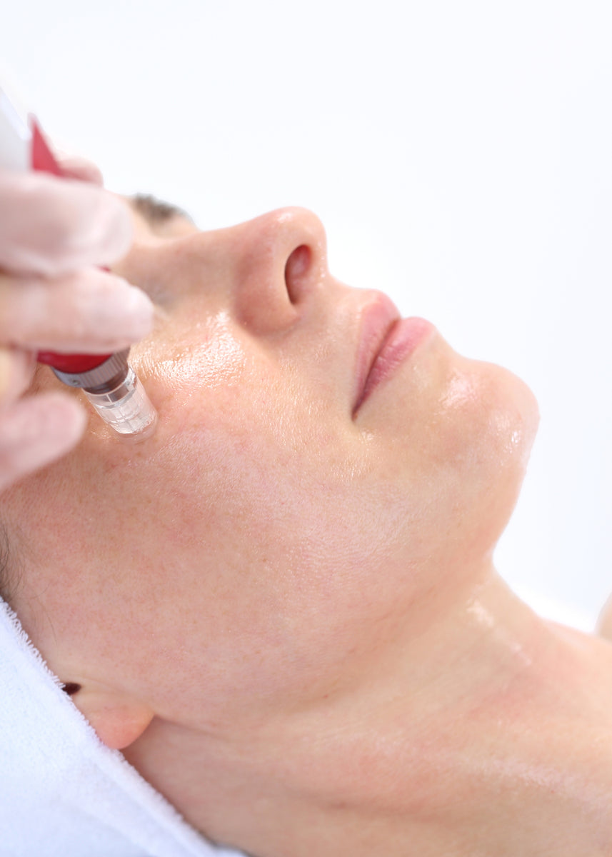 SKIN NEEDLING | COLLAGEN THERAPY – BEAUTYMEDIX